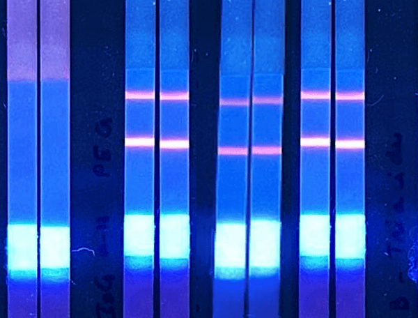 Ressources - Poly-Dtech